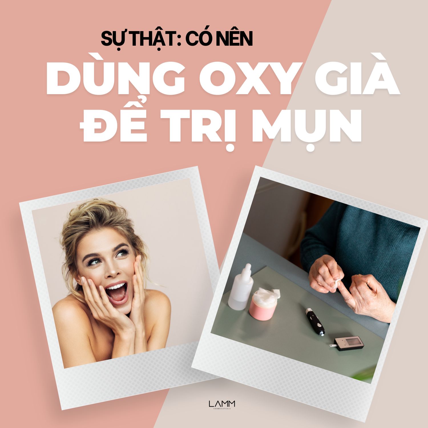 SỰ THẬT: DÙNG OXY GIÀ TRỊ MỤN CÓ HIỆU QUẢ VÀ AN TOÀN NHƯ LỜI ĐỒN?